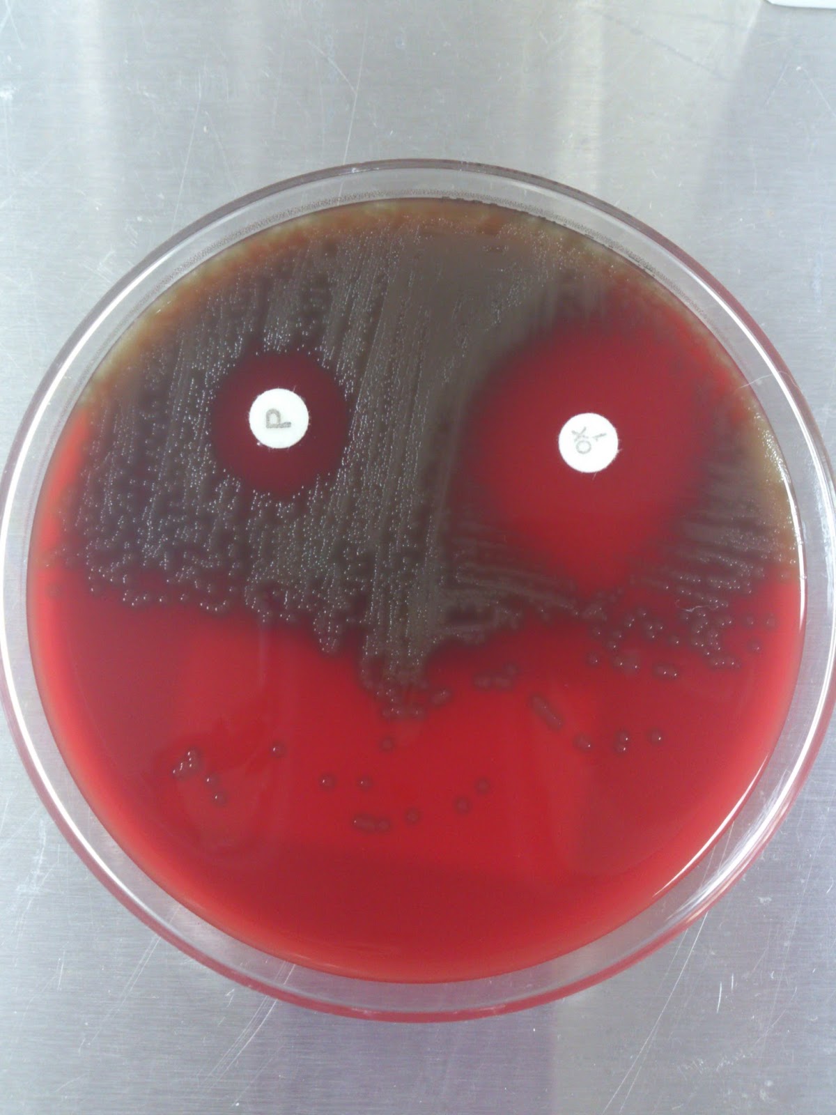 Prueba de la Optoquina | PARA TÉCNICOS DE LABORATORIO