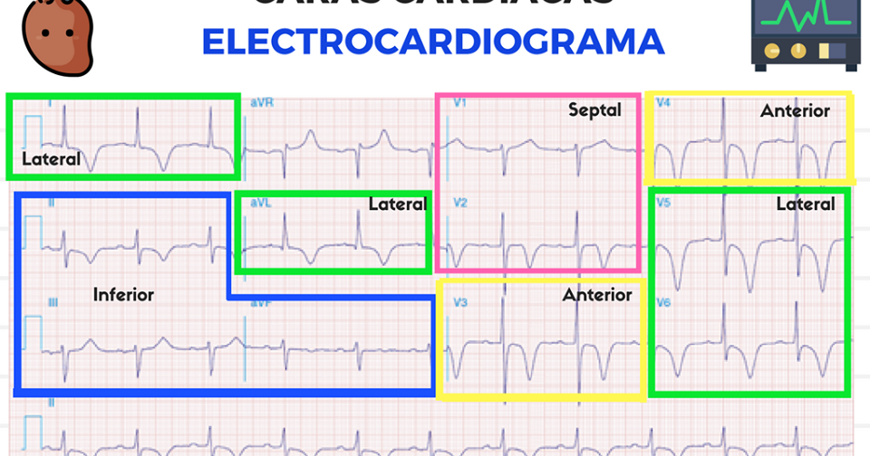 331-caras-cardiacas-electrocardiograma.png