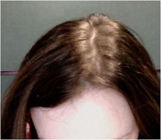 Killerstrands Hair Clinic