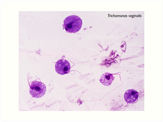 Trichomonas vaginalis - Microbiology Laboratory Turkey