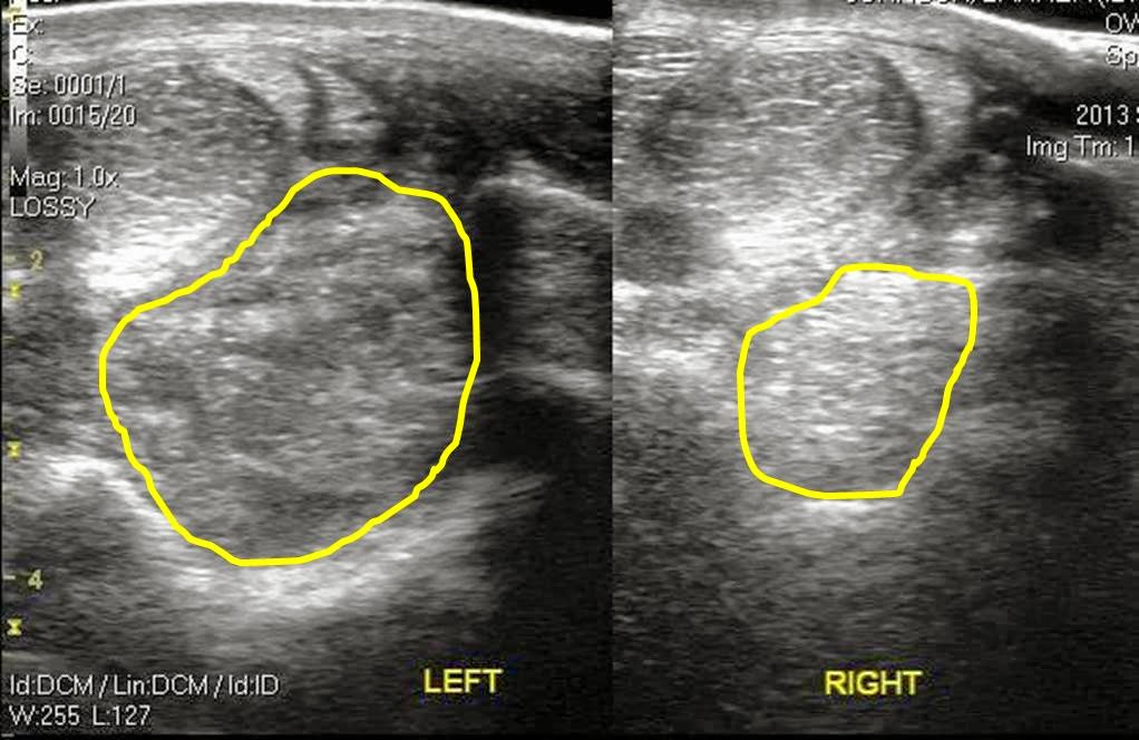 Michael Porter, Equine Veterinarian: Hind Limb Proximal Suspensory ...
