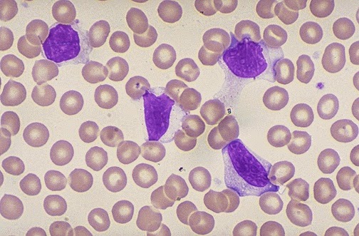 Image MCQs: Downey Cells | AcrossPG Blog!