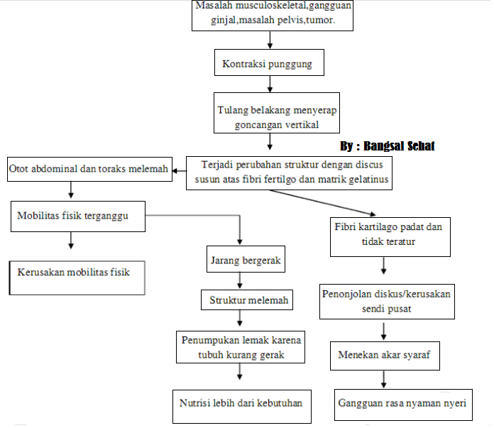 Laporan Pendahuluan low back pain (LBP), Download dalam bentuk doc dan pdf