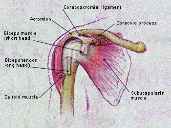 Subacromial Impingement Syndrome: Q: What Causes Subacromial ...