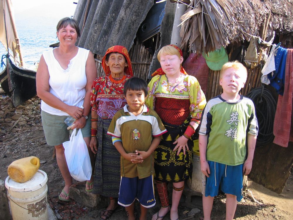 Deformutilation: Albinism Among The Kuna Indians