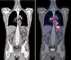 DIFERENCIA ENTRES RADIOGRAFÍA, UN TAC Y UNA RESONANCIA ~ OPAC