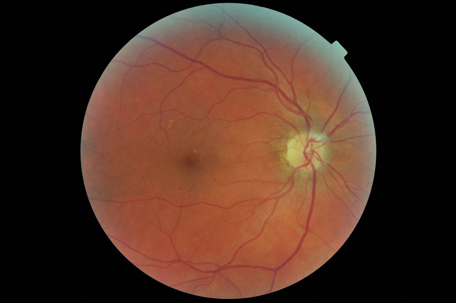 Ramblings Of Doug Why Regular Eye Exams Are Important Ramblings Of Doug Why Regular Eye Exams Are Important