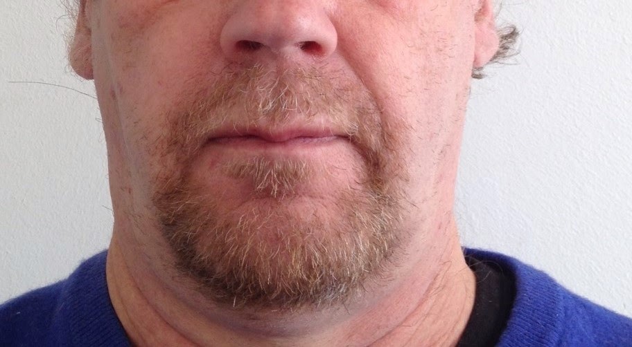 Album Amicorum: Baarden