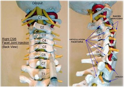 MEDICINA, SALUD Y CURIOSIDADES: DOLOR CERVICAL