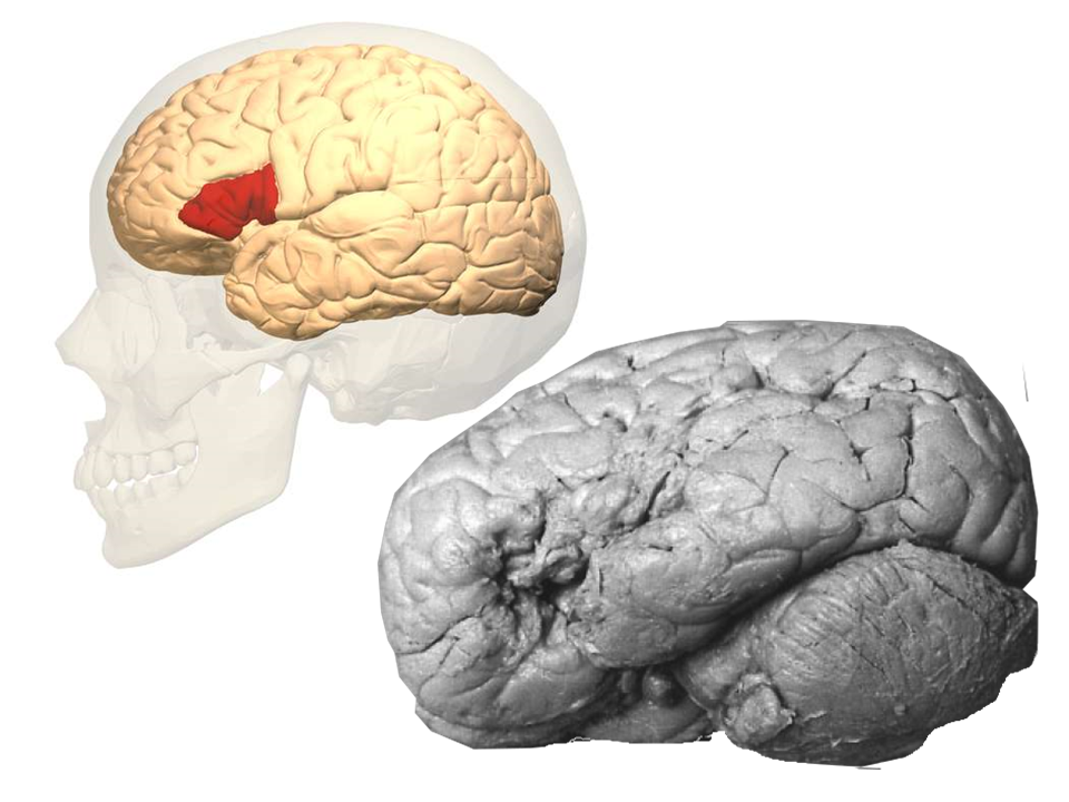 LE CERVEAU DE TANTAN, DANS LES MÉANDRES DE LA MORT.