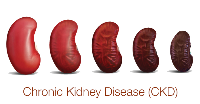 RENAL DISORDER