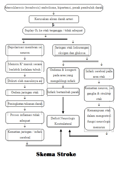 patofisiologi stroke | Post Kesehatan