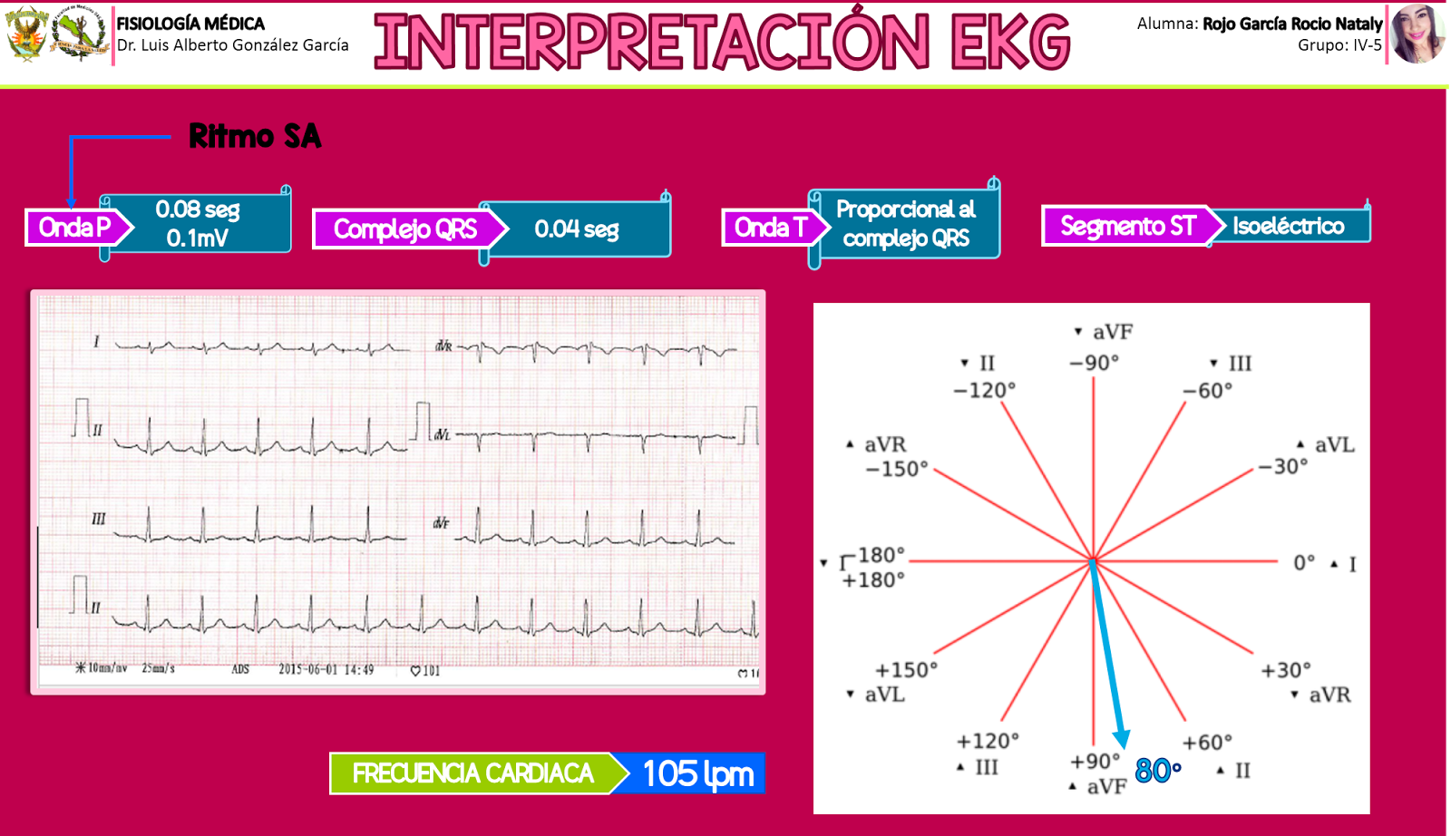 Fisiología ROGAR: ELECTROCARDIOGRAMA