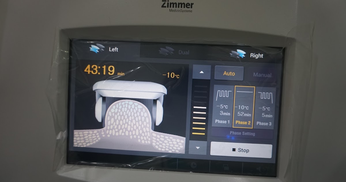 5 Little Angels: Z Lipo and Z Wave for Fat Reduction and Body ...