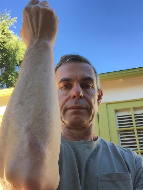 Roland Sturm: The worst scrapes are always on roads