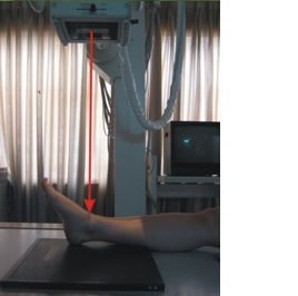 Radiología Silva2: Tobillo AP
