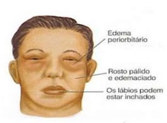 Dra. Karen Martínez : Tipos de facies