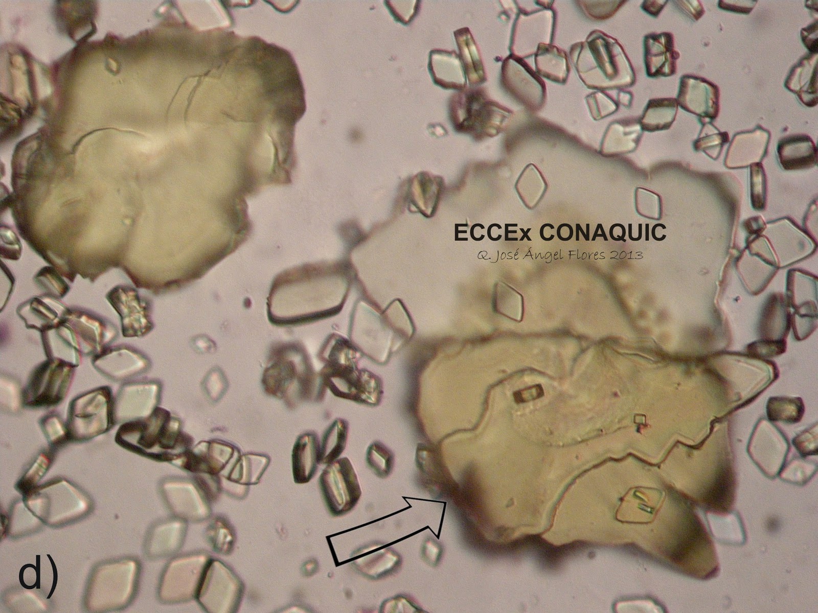 Caso UR- marzo-13 (Enfoque: cristaluria)