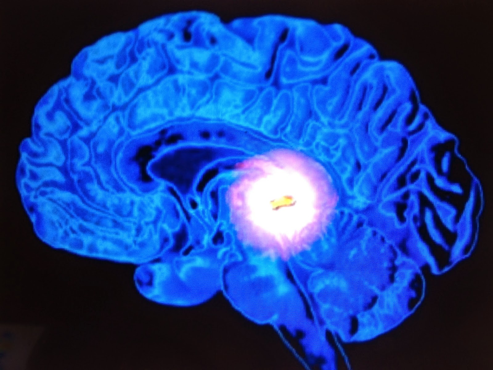 Eugene Ray Architect: LEONARDO'S PERSPECTOGRAPH / draws an armiillary ...