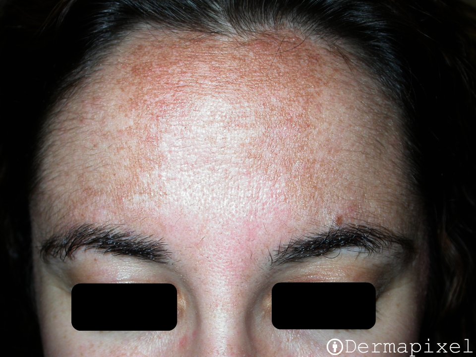 Dermapixel: octubre 2011