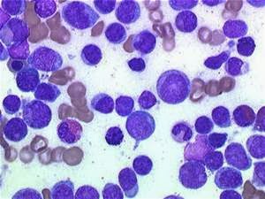 Easy Medical Terminology : Leukocytosis
