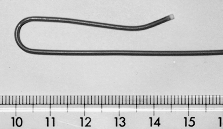 Ultimate Radiology : Simmons Catheter