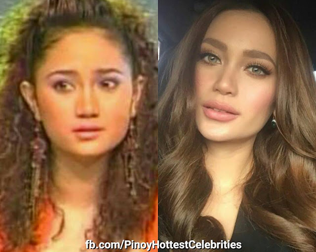 21 Before And After Photos Of Filipino Celebrities