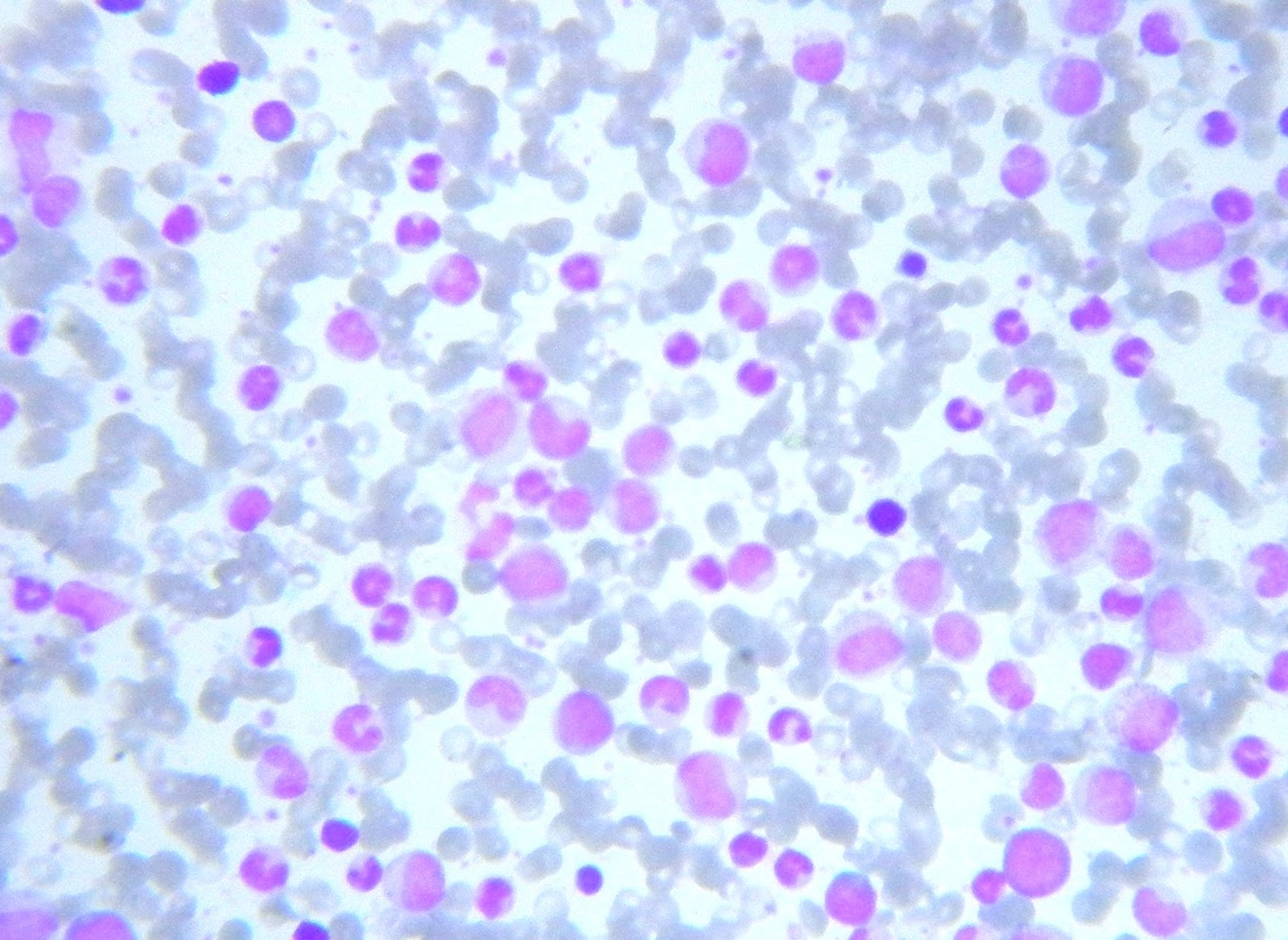 into the roots: Blood