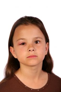 Periorbital puffiness - How to keep healthy - nyforall