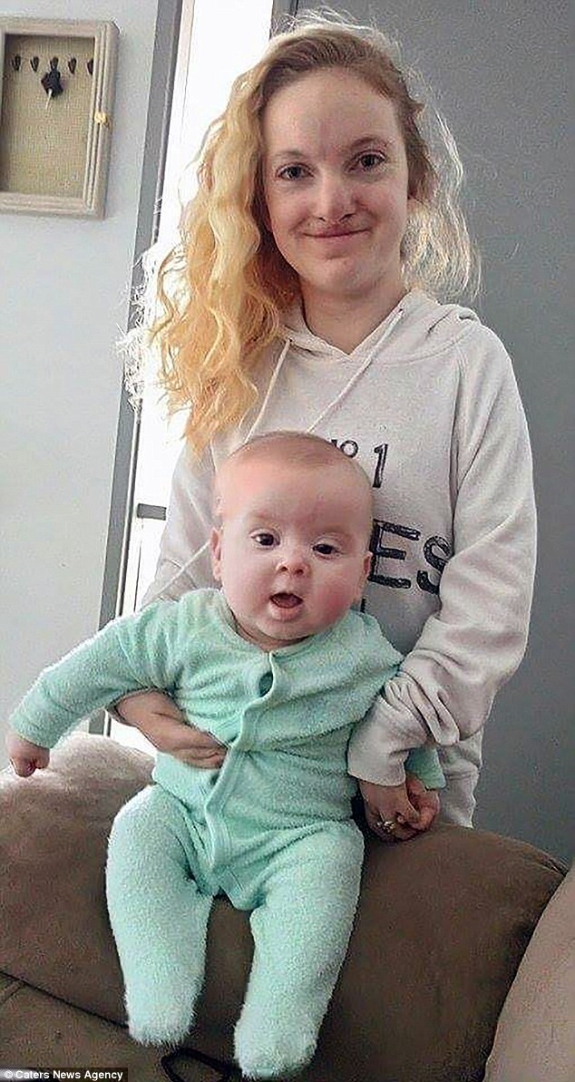 Woman With No Muscles In Her Arms and Legs Gives Birth To A Healthy Baby