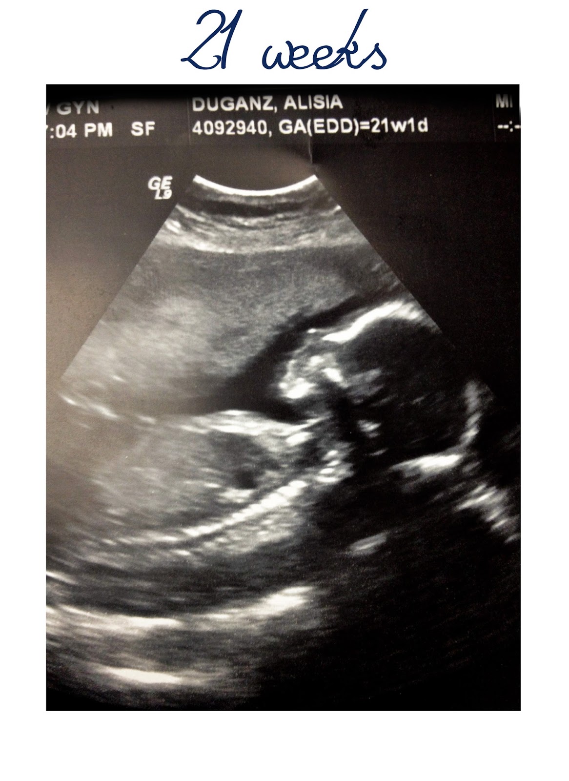 MetaData // Personal Photojournal by a Professional Photog: Baby at 21 ...