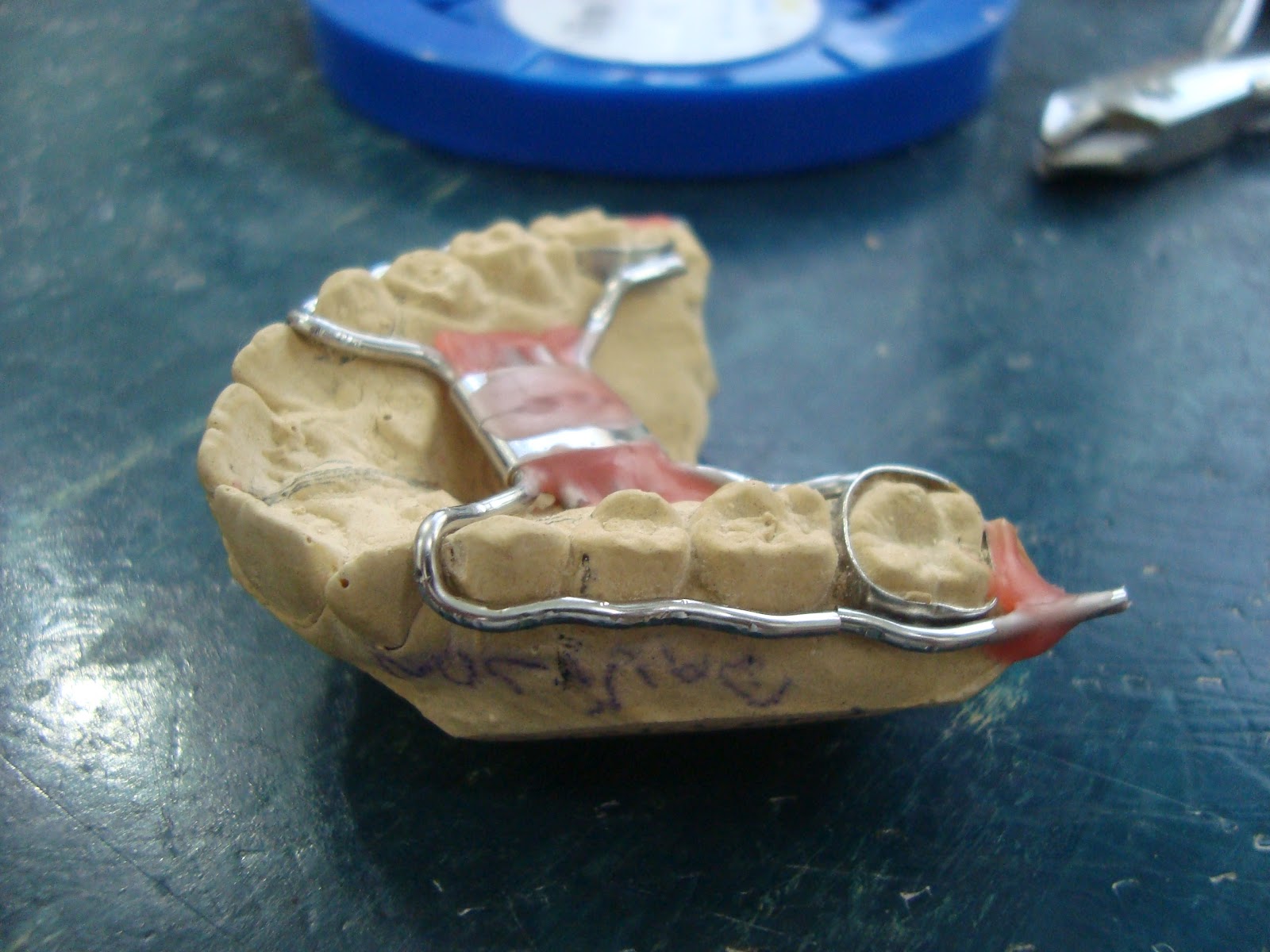 Laboratório Ortodôntico Bohrer: CONFECÇÃO DE HYRAX