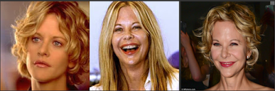 Meg Ryan Plastic Surgery Before and After Facelift and Botox - Star ...