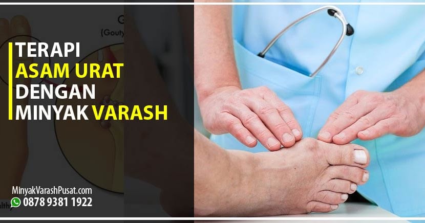 ALAMI, Obat Asam Urat atau Gout dan Cara Terapi pakai Minyak Varash