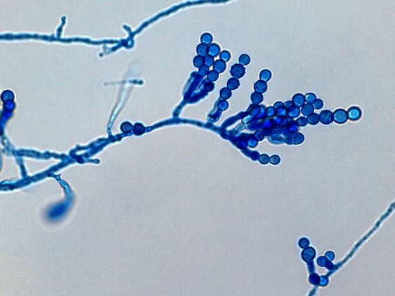 Fun With Microbiology (What's Buggin' You?): Scopulariopsis brevicaulis