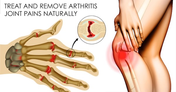 Treat Arthritis and Stiff Joints Once and For All - HEALTH TIPS