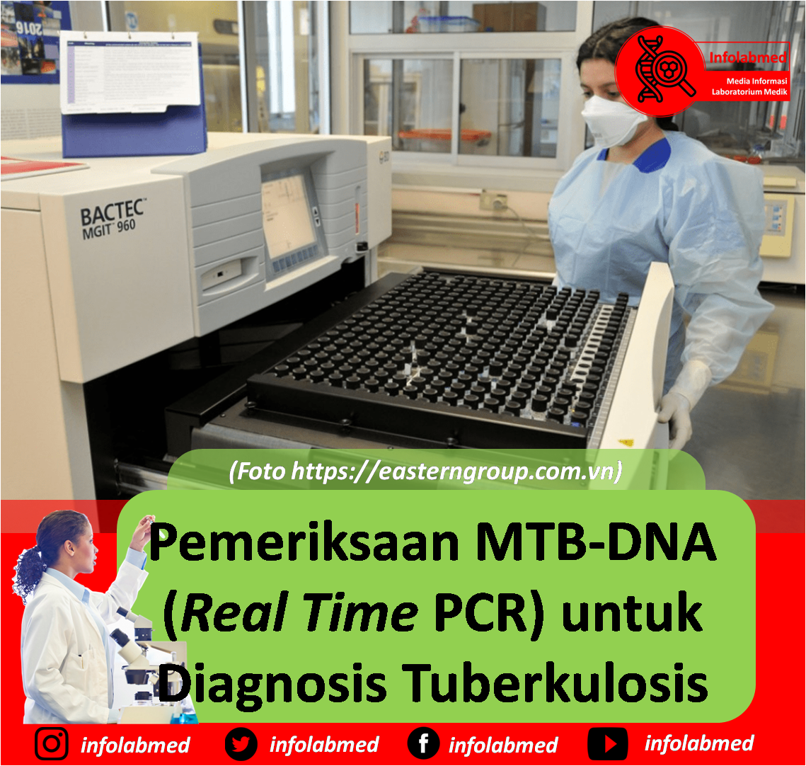 Pemeriksaan MTB-DNA (Real Time PCR) untuk Diagnosis Tuberkulosis