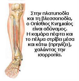 Δρ Νίκος Μακρίδης-Ειδικός παιδίατρος: Βλαισοποδία & Ραιβοποδία