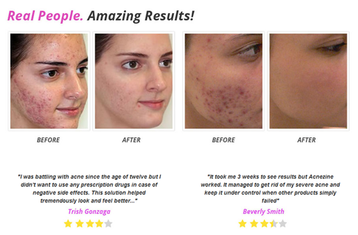 Acnezine - Health Offer