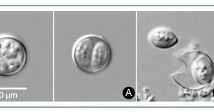 Avian Flu Diary: CDC HAN: Increased Cyclospora Infection, United States ...