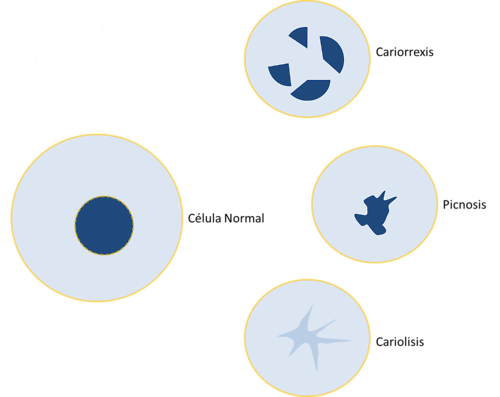 Patologia "B"irtual 2014: Necrosis y cambios morfológicos celulares.