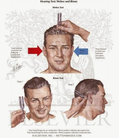 Enfermería Básica UCV : VALORACIÓN SISTEMA NEUROLOGICO