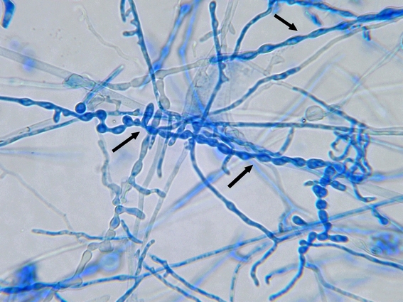 Fun With Microbiology (What's Buggin' You?): Microsporum audouinii