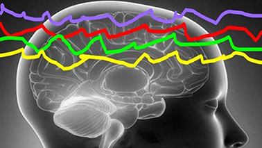 El Cerebro de Niños y Adolescentes: Deterioro Cognitivo Leve