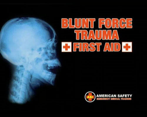 Nurses Make a Difference: First Aid Blunt Force Trauma