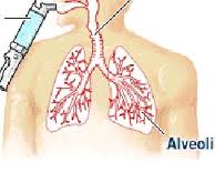 ROUTE OF DRUG ADMINISTRATION ( Part 3/3 ) - Its All About Pharma