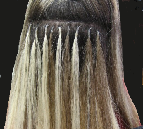 El Baúl Radiológico: EXTENSIONES CAPILARES POSTIZAS: ASPECTO EN TC ...