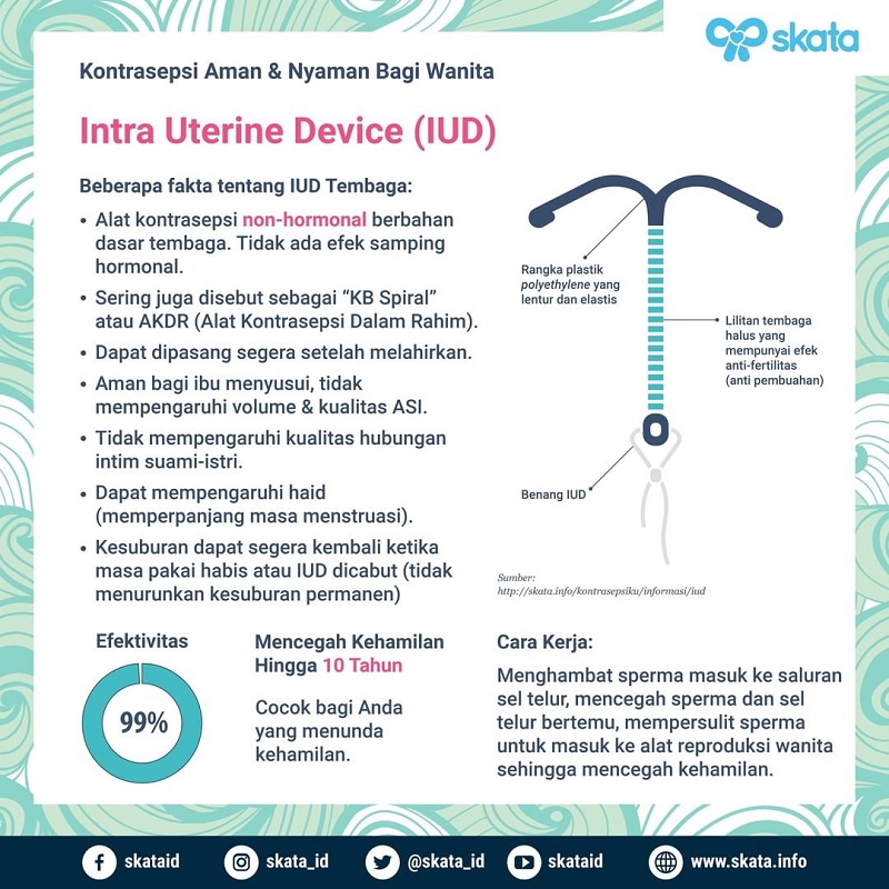 Bongkar - Pasang (Kembali) IUD. Bolehkah? - Lendyagasshi