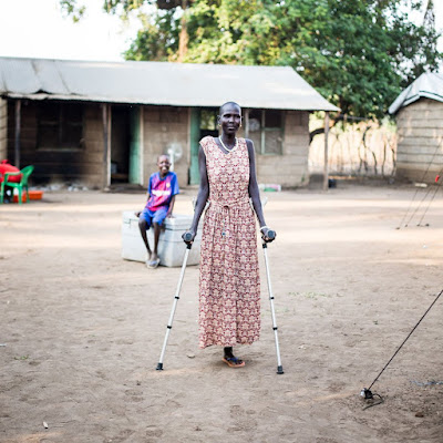 Photos: This black beauty shot by rebels and had her leg amputated is ...