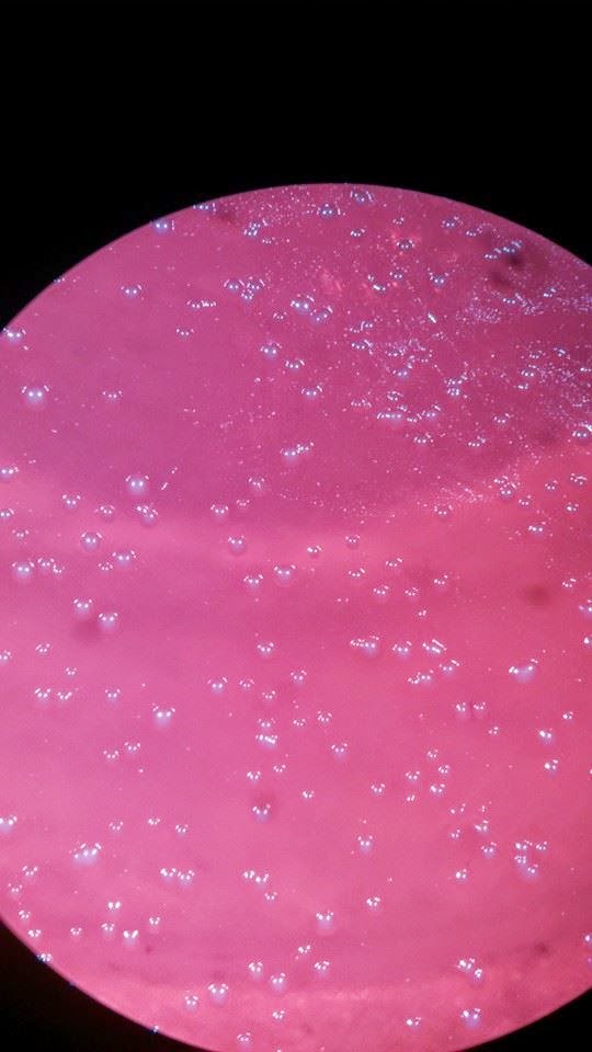 Rachel and Sarah's Medical Microbiology Lab Journal: May 2014